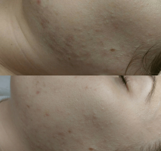 ᐉ Restructurer Innoaesthetics 5 мл — купить Restructurer по выгодной цене